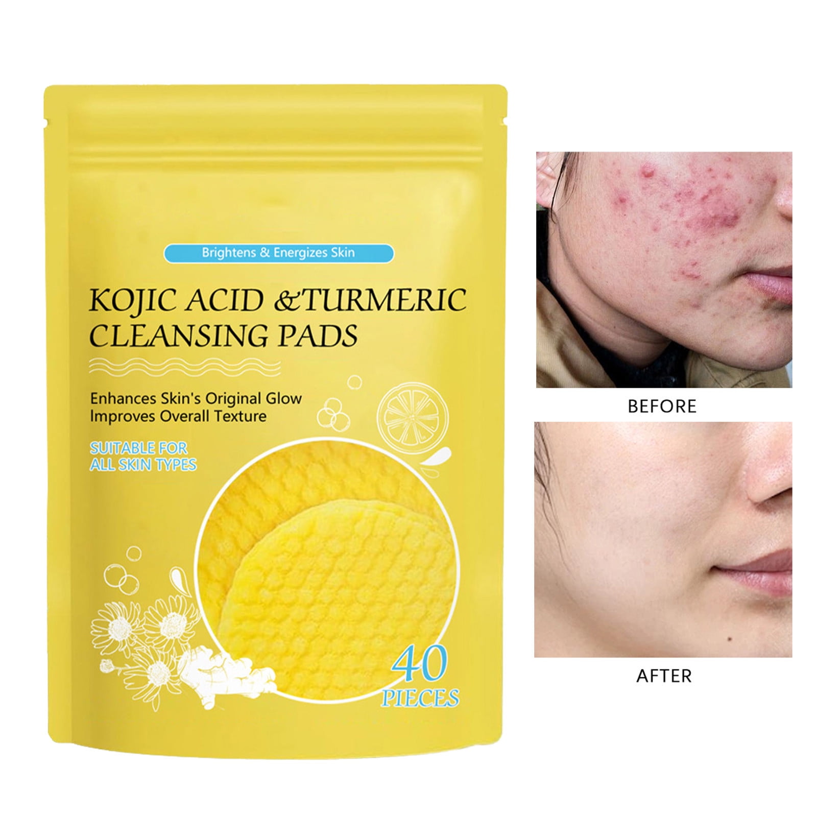 Zenghuiiii Kojic Facial Cleansing Pads For Dark Brightens Skin Excess ... Zenghuiiii Kojic Facial Cleansing Pads For Dark Brightens Skin Excess ...