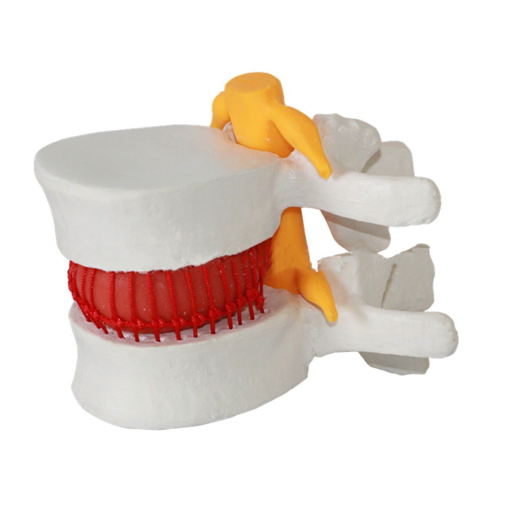 Ziuscore PVC Lumbar Vertebrae Model Realistic And Innovative For Easy ... Ziuscore PVC Lumbar Vertebrae Model Realistic And Innovative For Easy ...