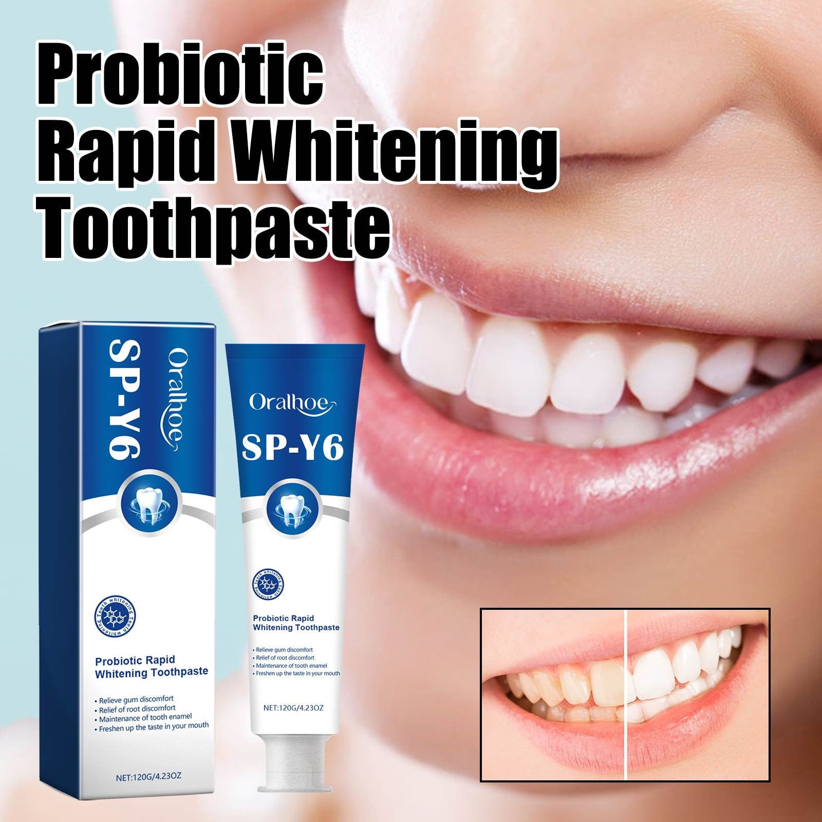 Ziynglg Natural Whitening SP Y6 Toothpaste with for Coffee,Tea Wine ...