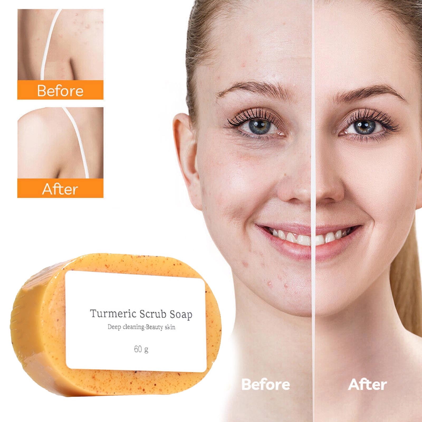 Ziynglg Turmeric and Lemon Kojic Soap Tablets for Brightening and ...
