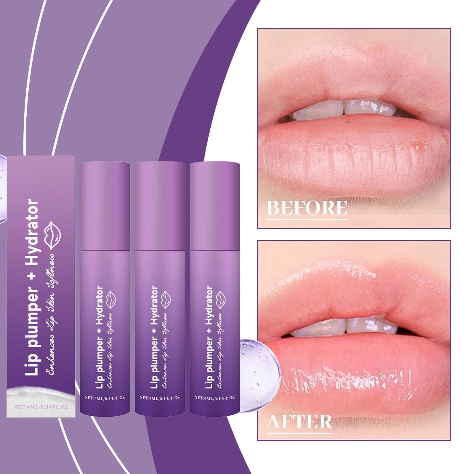 Ziynglg Ultimate Moisturizing Lip Balm for Lips All Day Nourishment ...