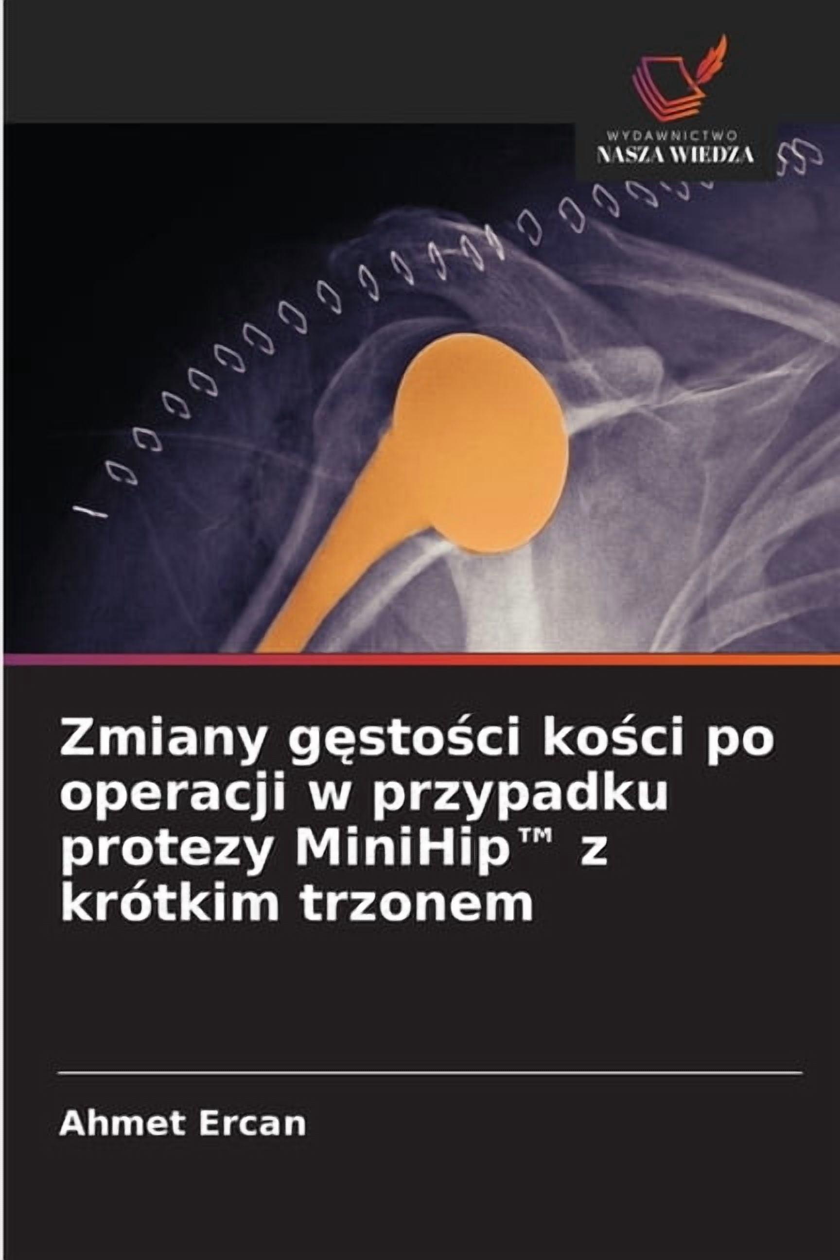 Zmiany gęstości kości po operacji w przypadku protezy MiniHip(TM) z ...