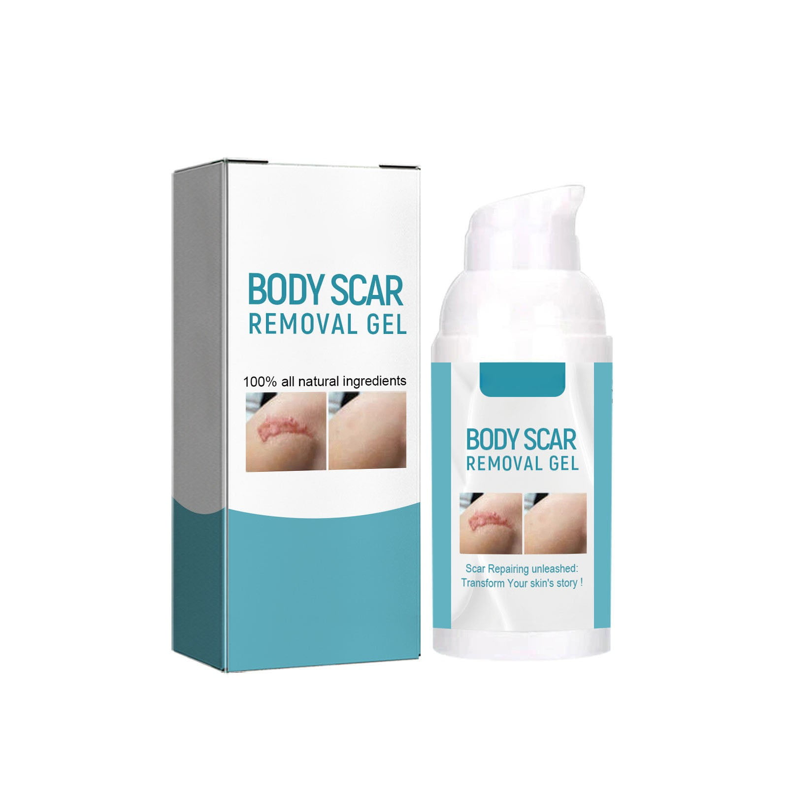 aneralied Scar Gel, Scar Cream, Advanced Scar Gel for Surgical Scars ...