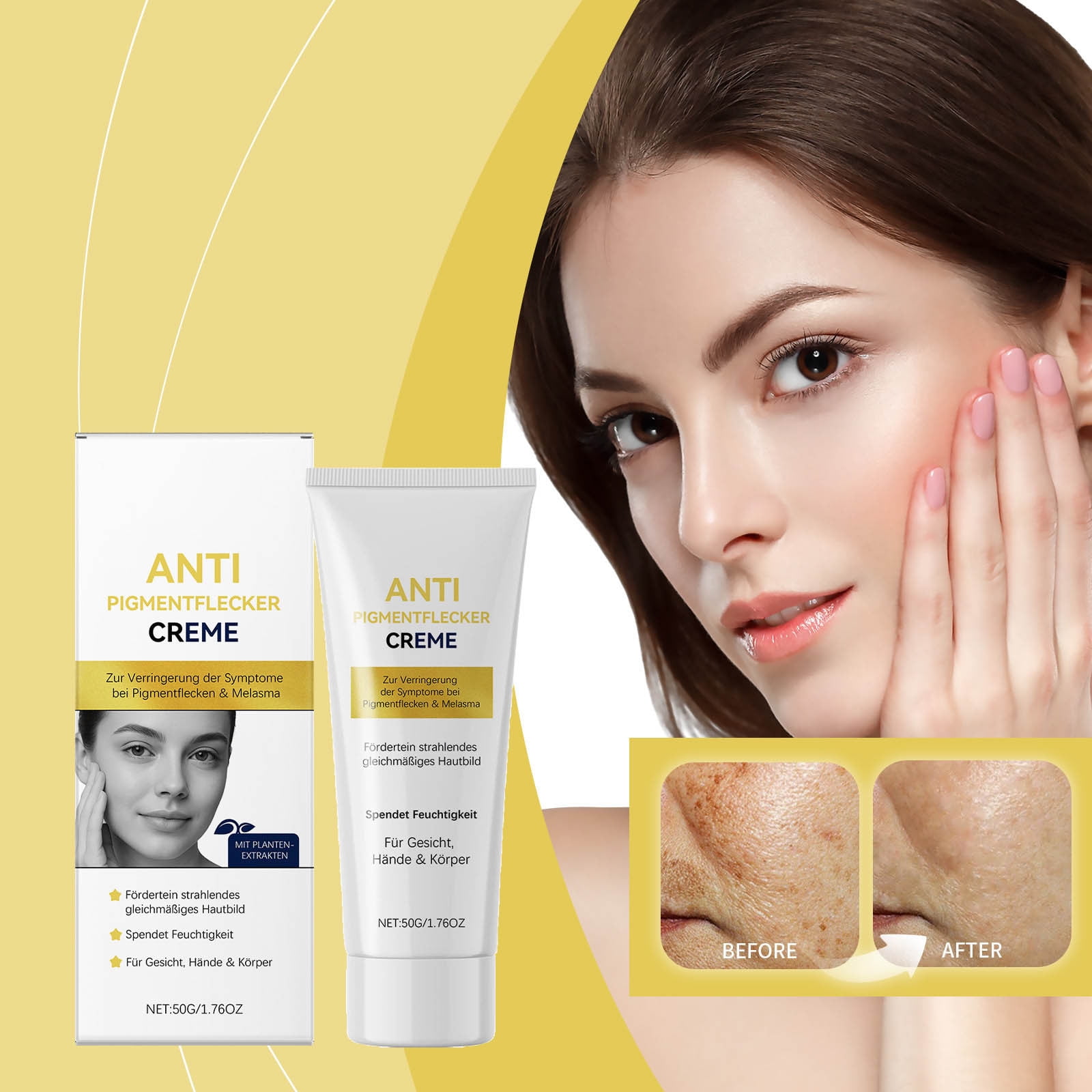 anti-Pig®mentflecker Cream Pig®ment With Natural Extracts Against Mel ...