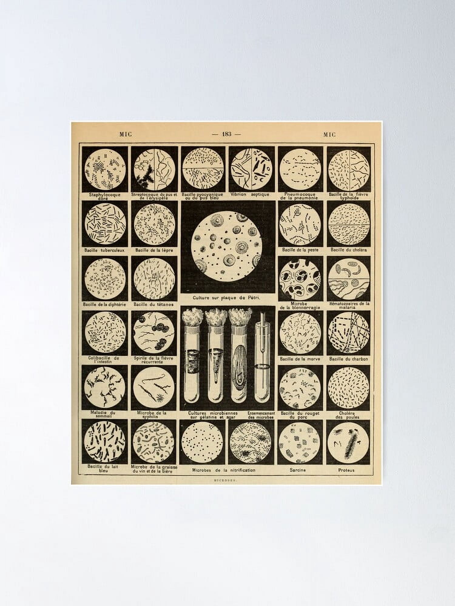 bacteria culture vintage french science journal Poster - Walmart.com