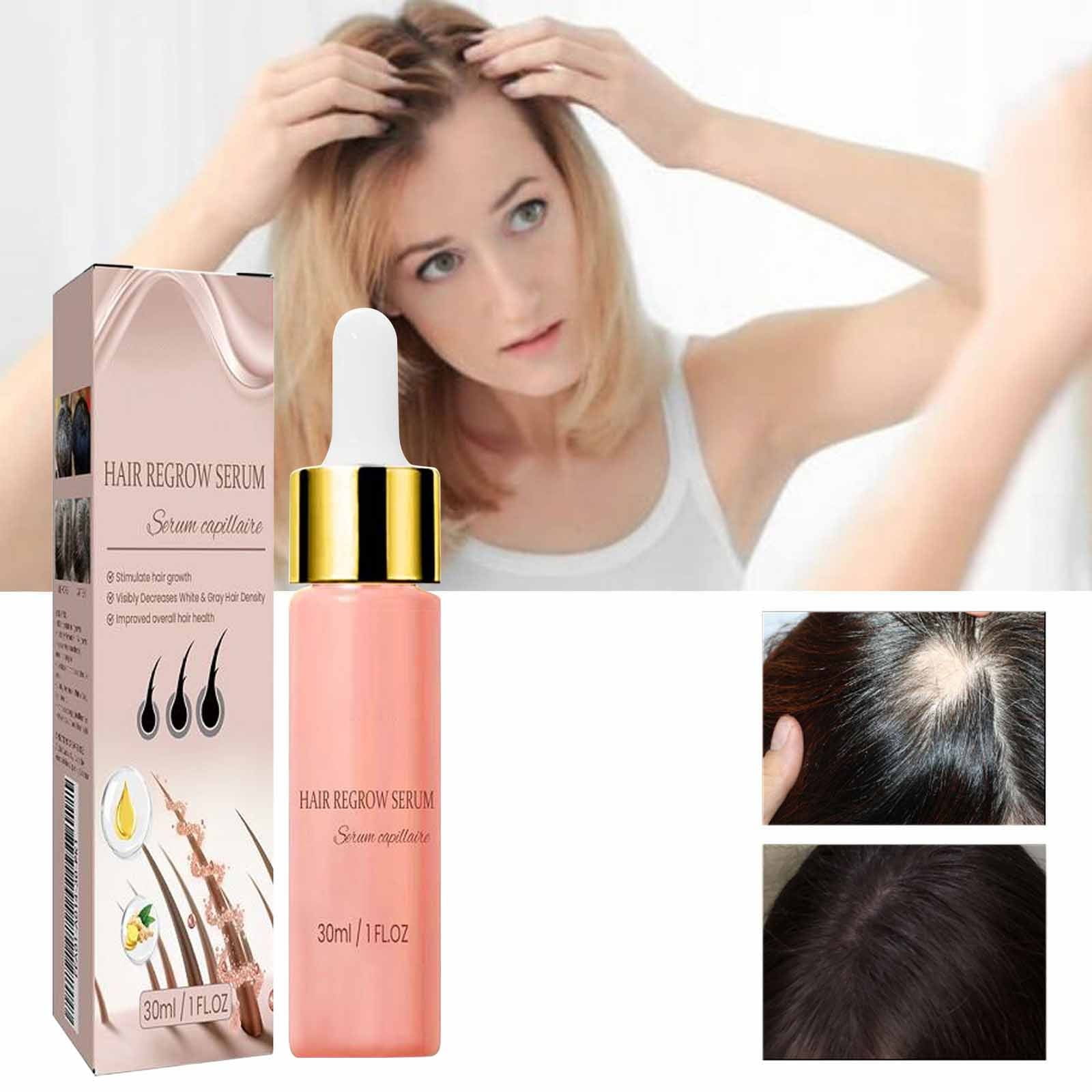 cuyhtdup Red Extract Contains Curcumin Mung Extract Castor Oil Ginger ...