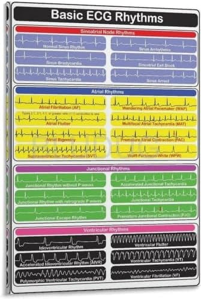 ekg knowledge poster,basic ecg rhythms poster,ekg heart rhythms poster ...