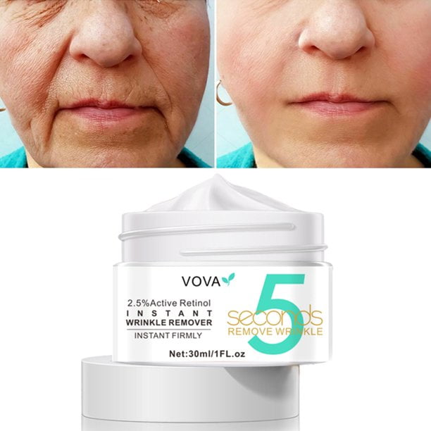 gluttony Wrinkle Remover Cream, 5 Seconds Instant Firming Remove Puffy ...
