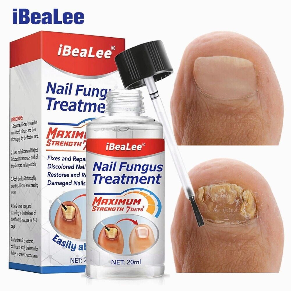 iBeaLee 7DAYS Extra Strong Nail Fungus Treatment, Anti-Fungal Toenail Revitalizer, Finger Nail ...