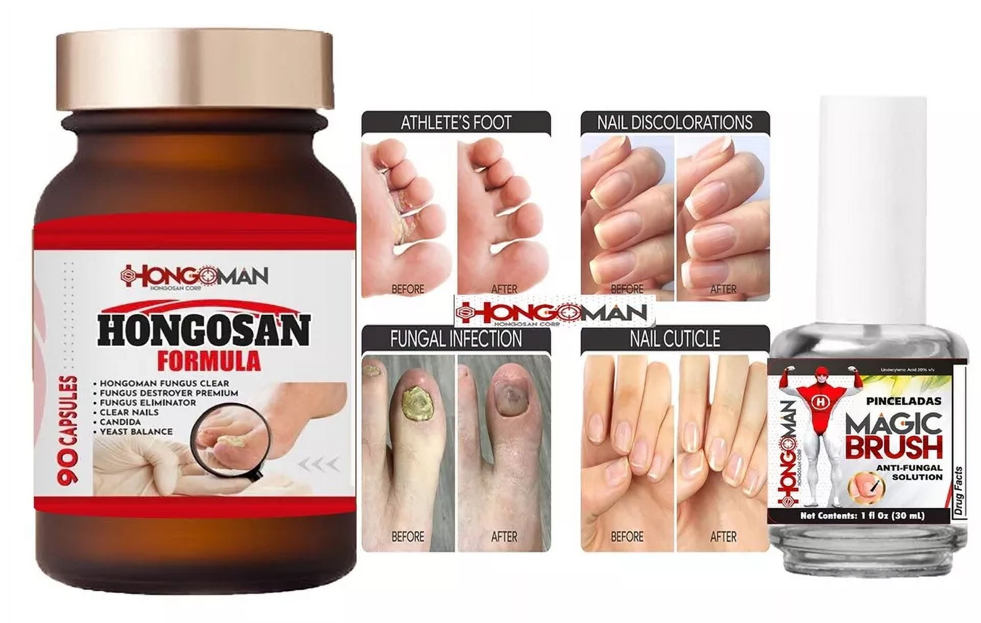 kit anti-fungal finger nail foot feet skin support itching toenail ...