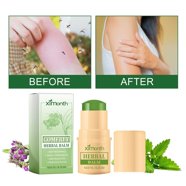 Leader Calamine Plus Anti-Itch Lotion, External Analgesic, Skin ...