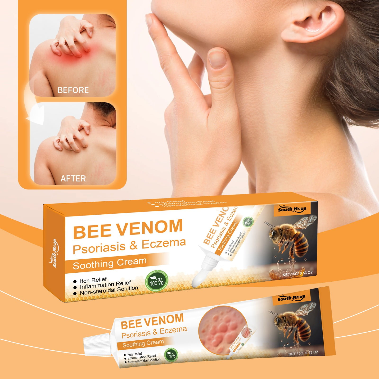 on Sale! WEANT Seborrheic Dermatitis Paste,Psoriasis Anti-itch Paste ...