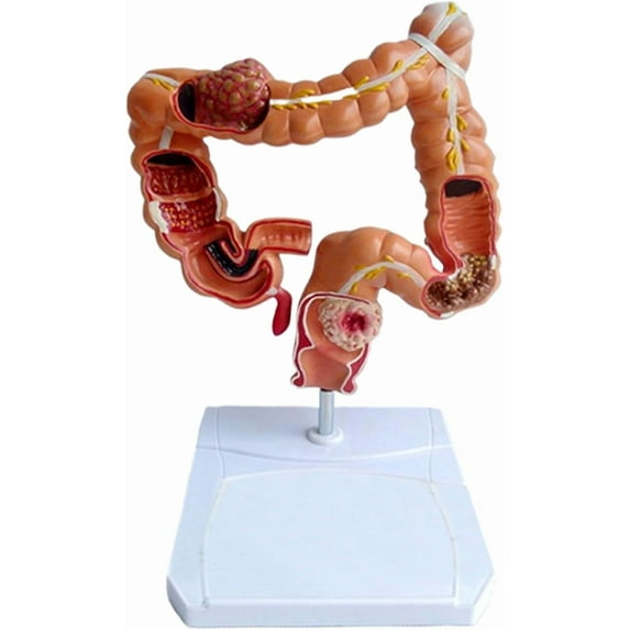 qczoyp Science Anatomy Physiology Model: Human Large Intestine ...