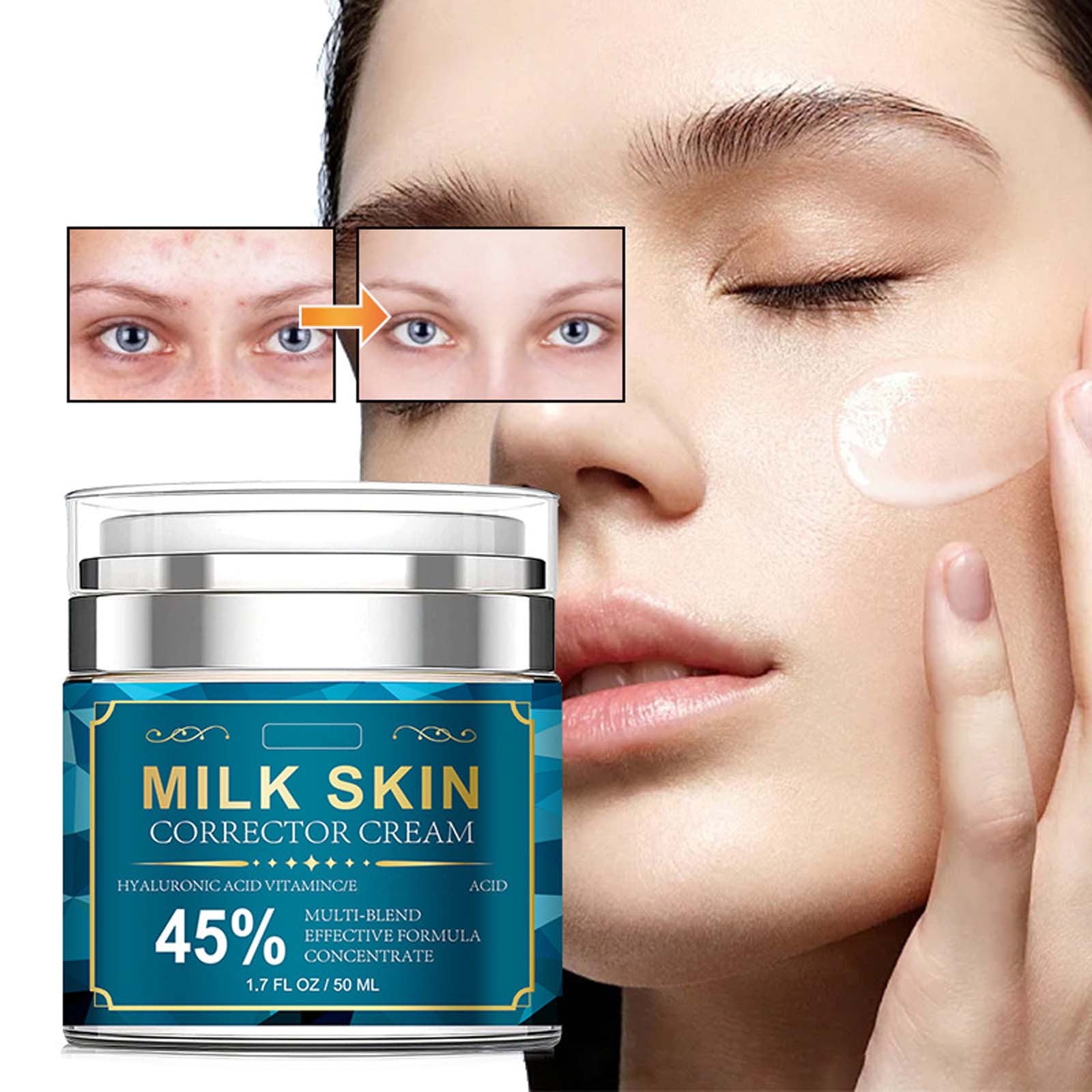 xaoyunyn Milk Skin Corrector Cream for Dark Spots and Age Spots for ...