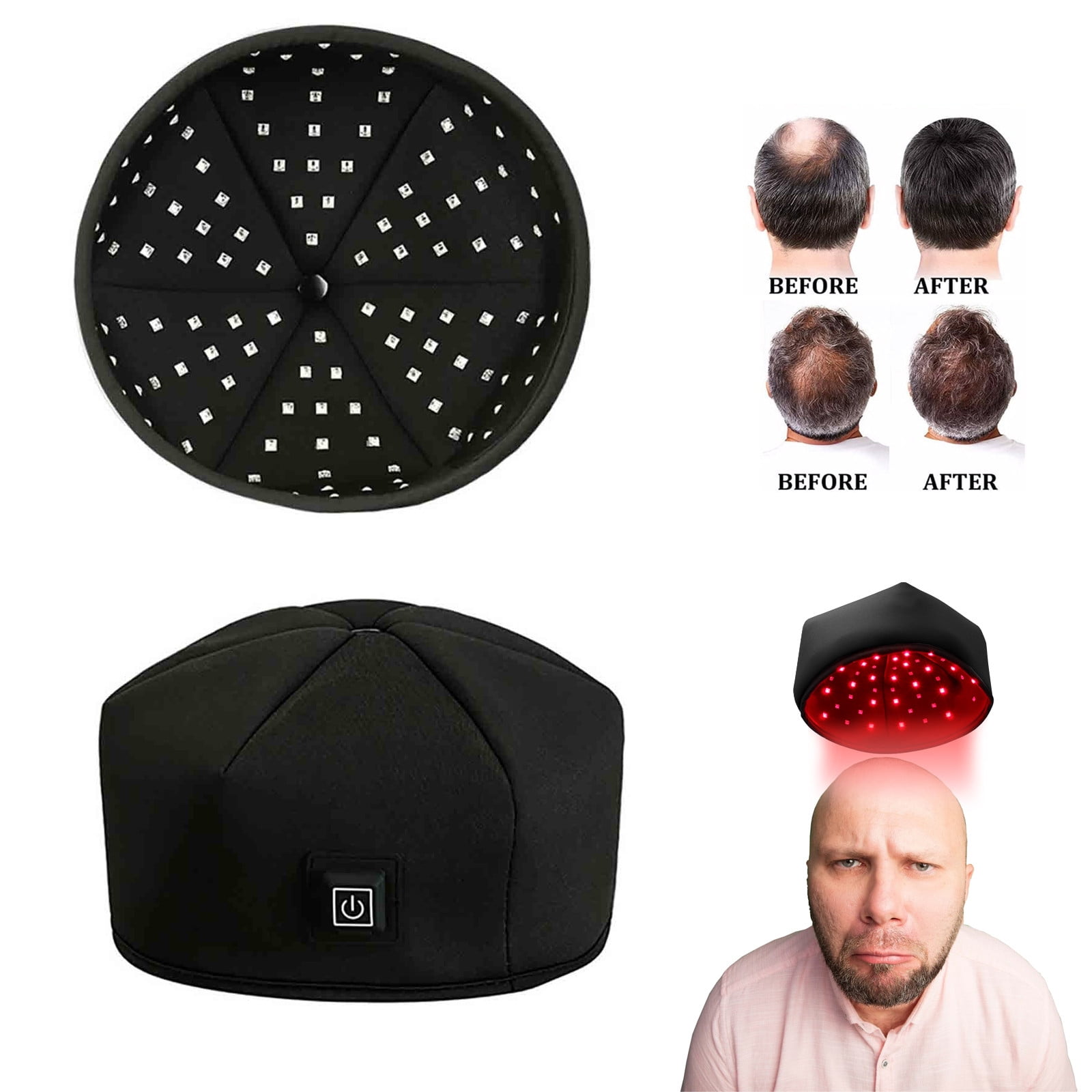 xaoyunyn Mobile Light Cure Cap for Hair Growth with Advanced Infrared ...