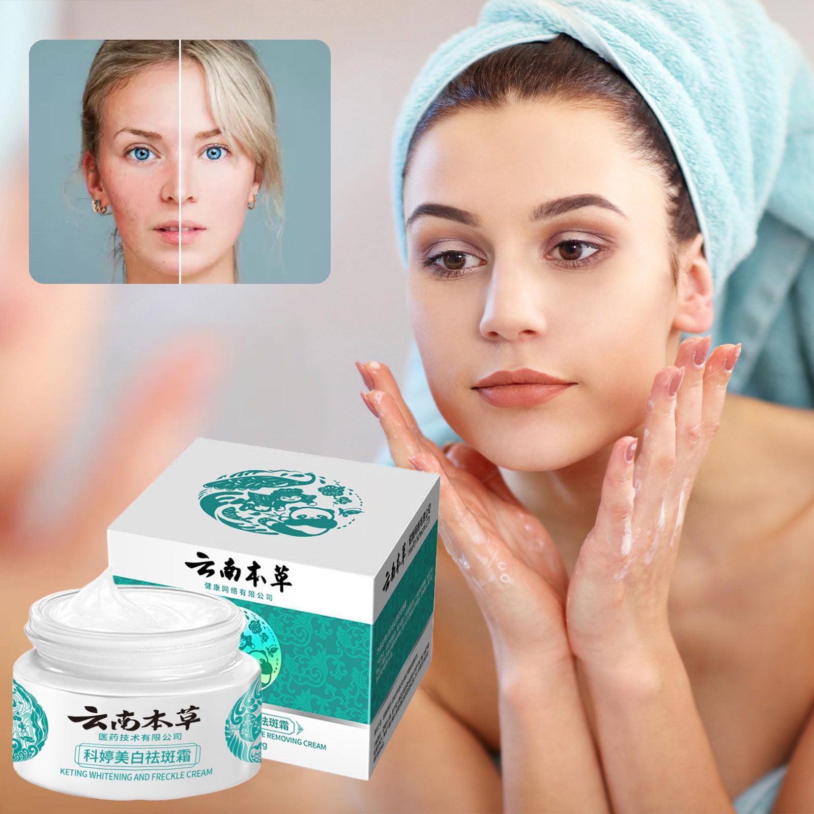 xaoyunyn Instant Results Skin Tone Corrector Moisturizer for Dark Spots ...