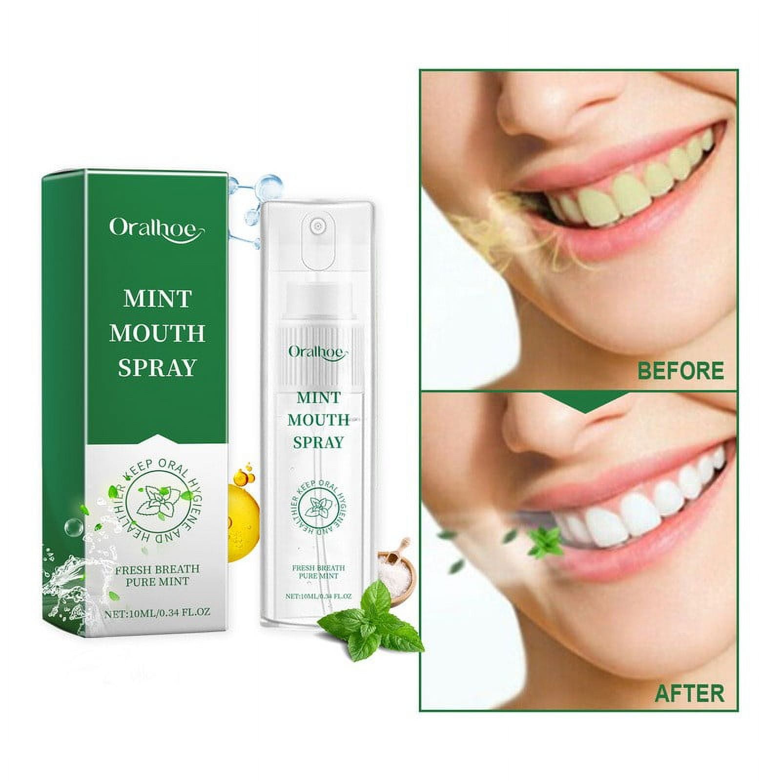 xaoyunyn Natural Plant Extract Oral Care Spray 0.34oz for Fresh Breath ...