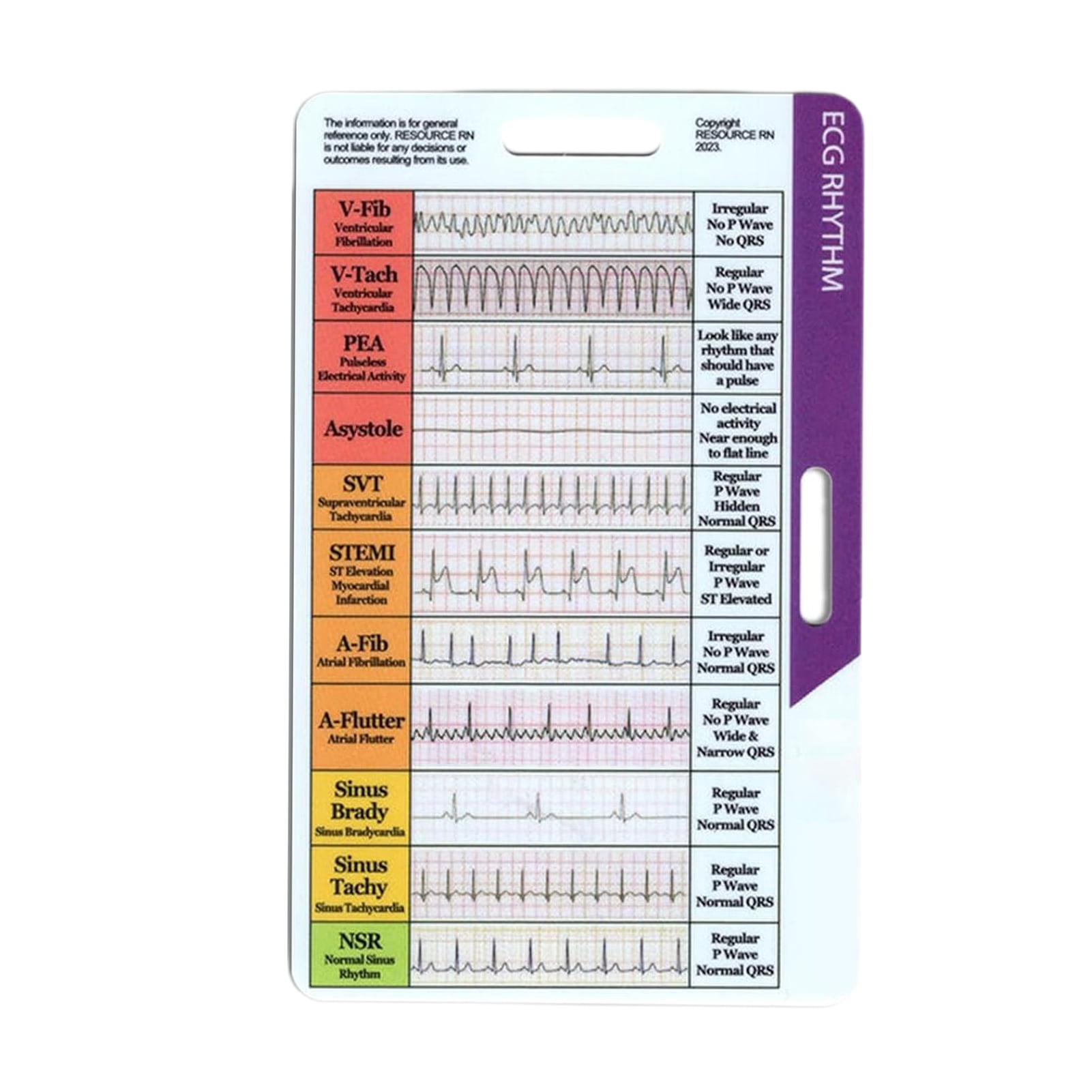 ziertyon 1/2Pcs EKG Rhythm Pocket Card Double Sided EKG Rhythm Interpretation Reference Card ...
